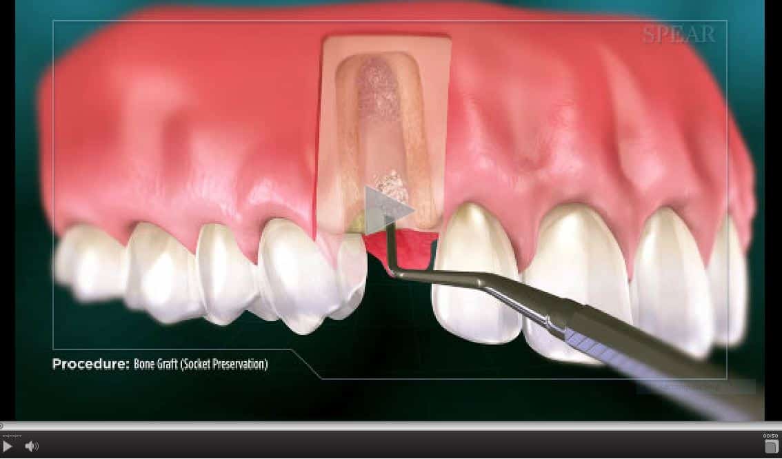 Videos - Nebo Dental Centre | Dentist In Hamilton
